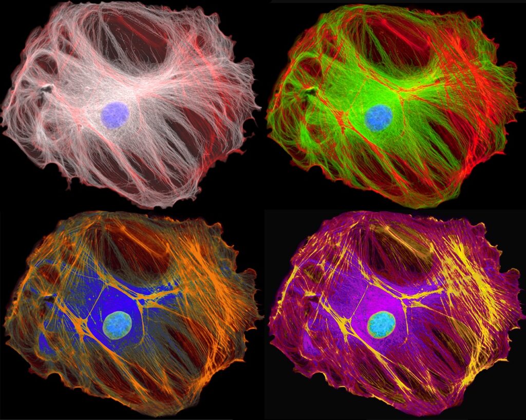 Recreational Biology: Topological Puzzles at Cellular Scales - Aspen ...